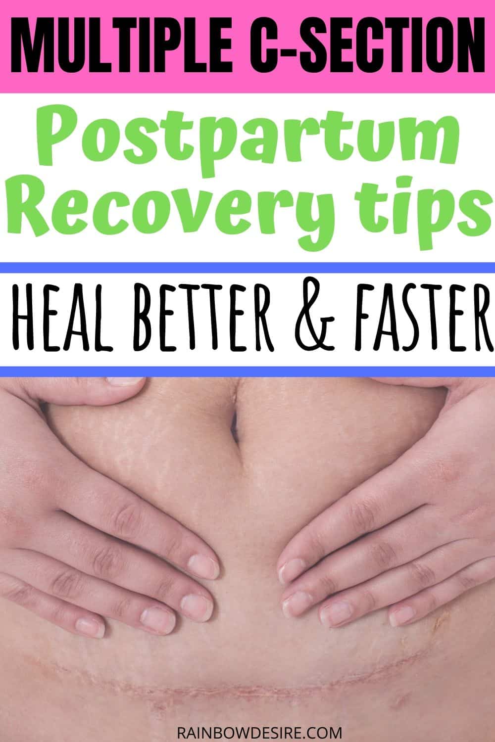Post C-Section Recovery and care Tips for moms - Rainbow Desire